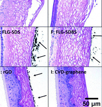 Graphene not irritant to skin, study shows – Graphenea